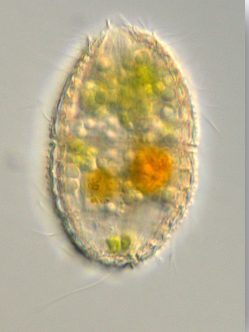 2025 Coleps - Society of Eukaryotic Microbiology